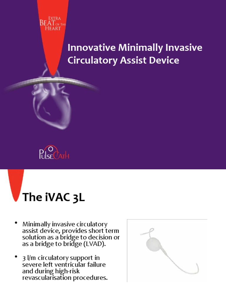 Innovative Minimally Invasive Circulatory Assist Device | PDF | Home ...