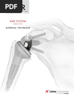 Tornier Flex Shoulder System Operative Technique | PDF | Shoulder | Anatomical Terms Of Motion