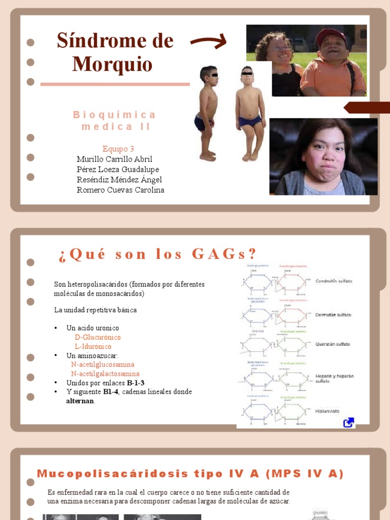 Sindrome de Morquio (1) | PDF | Medicina CLINICA | Especialidades Medicas