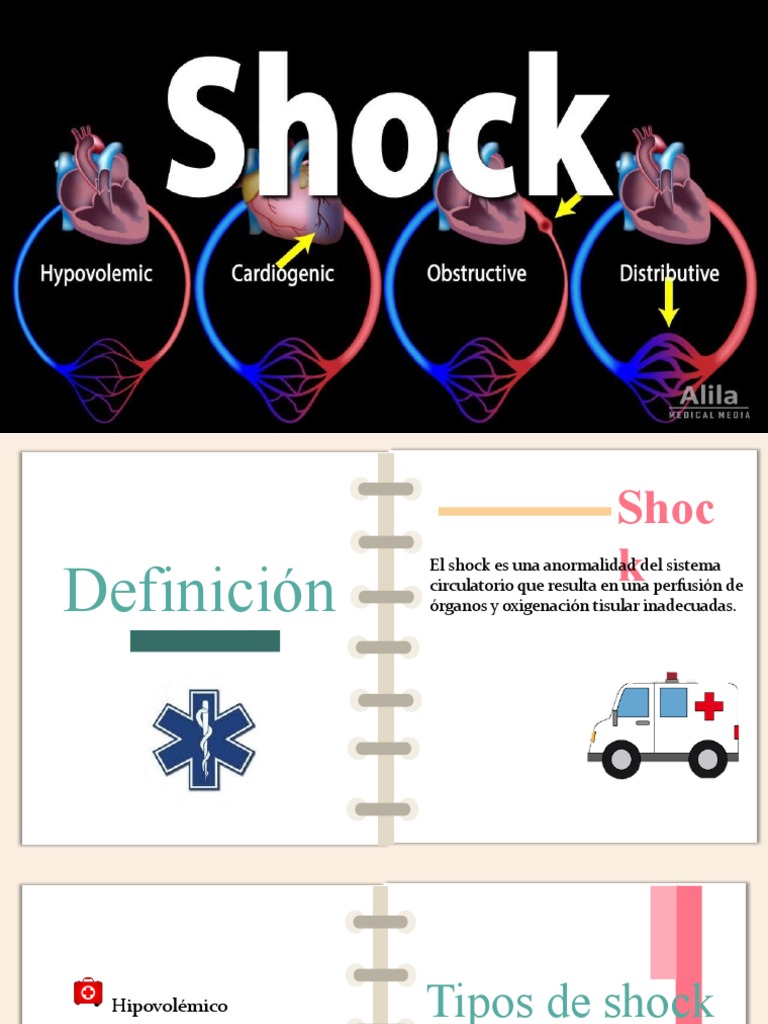 Shock | PDF | Infarto de miocardio | Epidemiología