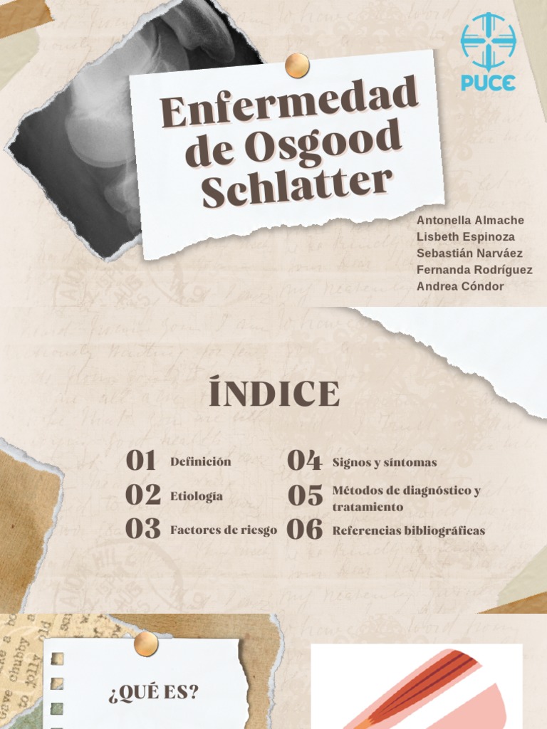 Enfermedad de Osgood Schlatter | Descargar gratis PDF | Rodilla | Extremidades (anatomía)