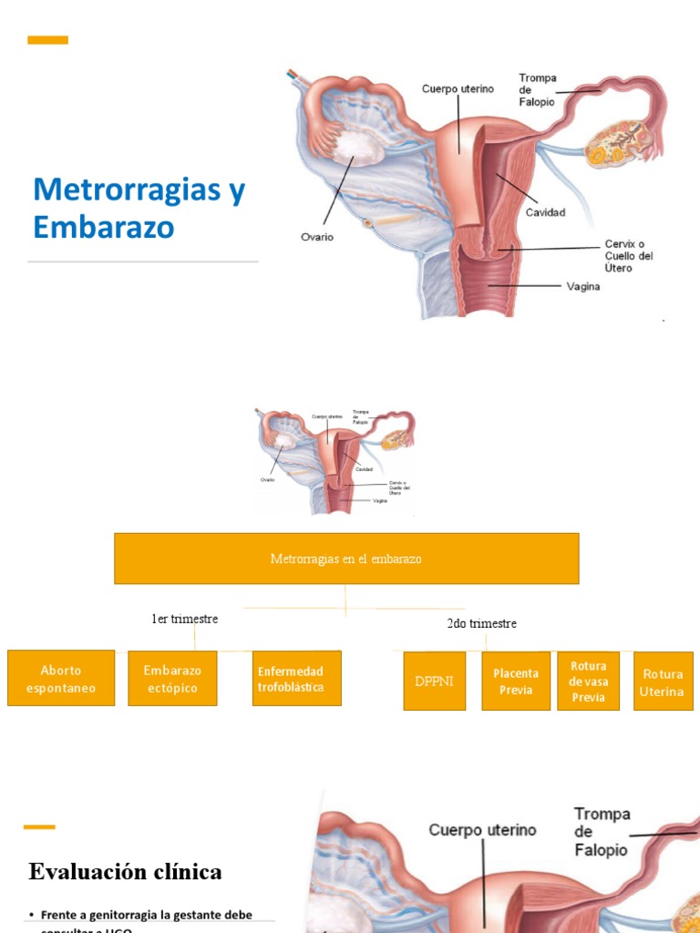 Metrorragias y Aborto en Embarazo | PDF | El embarazo | Placenta