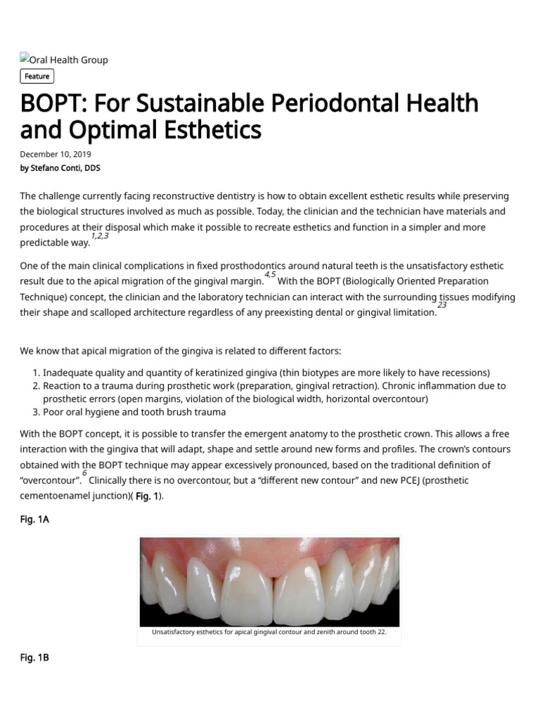 BOPT - For Sustainable Periodontal Health and Optimal Esthetics | PDF | Periodontology | Dentistry