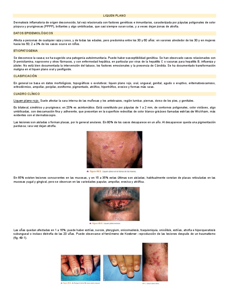 1.liquen Plano | PDF | Perdida de cabello | Condiciones cutáneas
