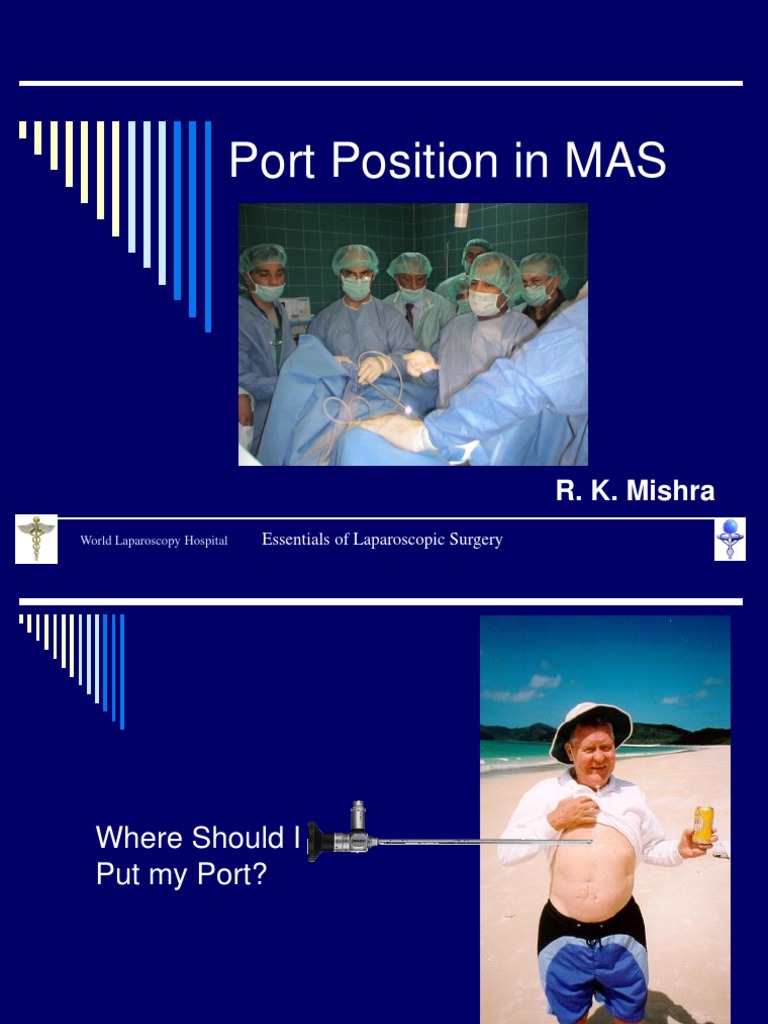 Port Position in Laparoscopic Surgery | PDF | Medical Specialties | Surgery