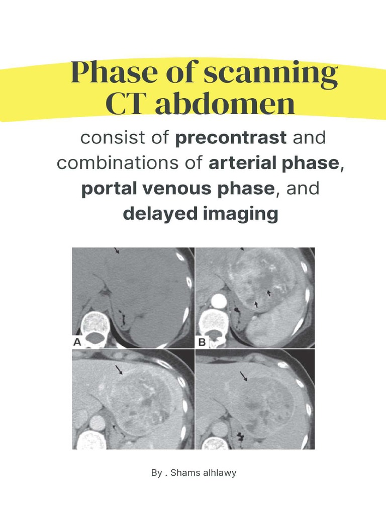 Phase of Scanning CT Abdomen | PDF