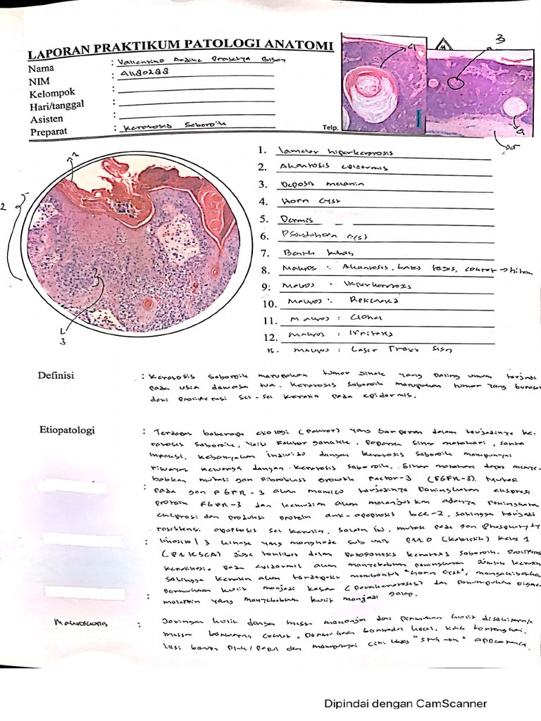 Vallentino Ardine Prasetya Bisay - Laporan Buku Besar | PDF