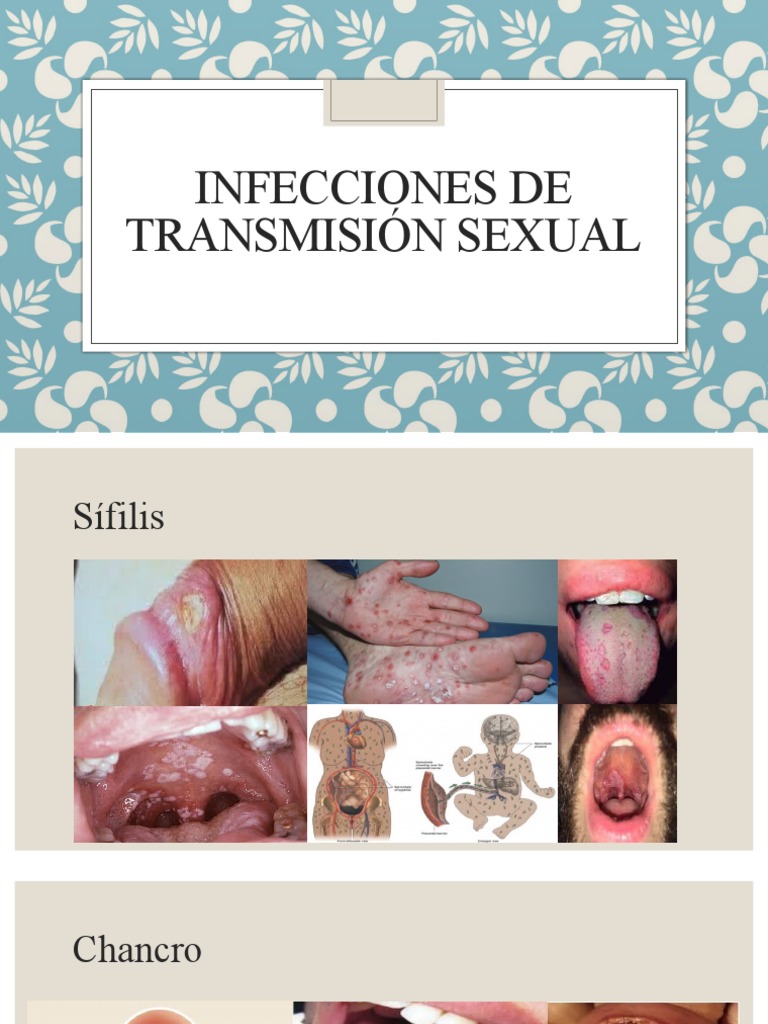 Infecciones de Transmisión Sexual | PDF