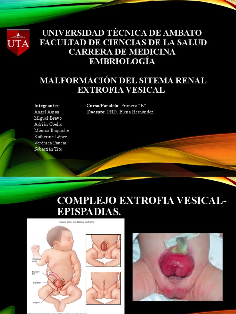 Extrofia Vesical | PDF | Vejiga urinaria | El embarazo