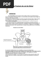 Classification des Fractures de Schatzker | PDF