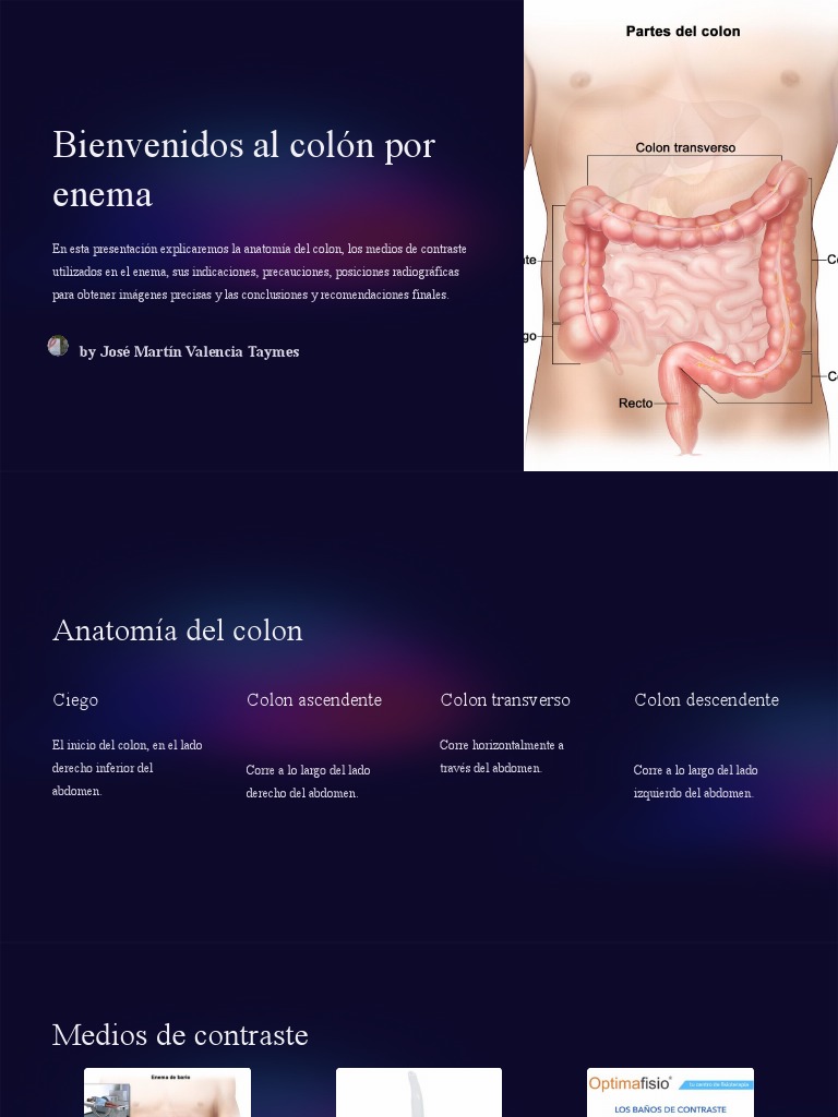 Enema de Colon: Anatomía y Procedimientos | PDF | Cáncer colonrectal ...