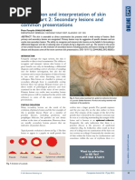 Pruritus Analog Scale 1 PVAS | PDF