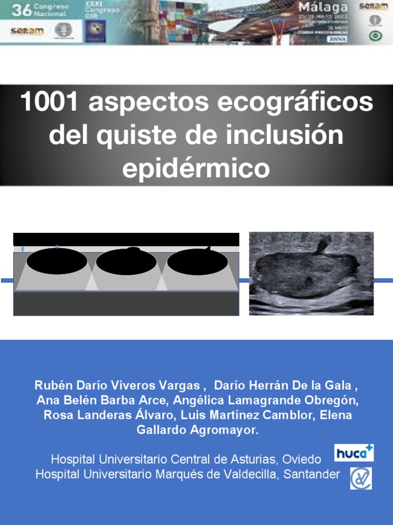 Quiste de Inclusion Epidermica | PDF | Piel | Ultrasonido médico
