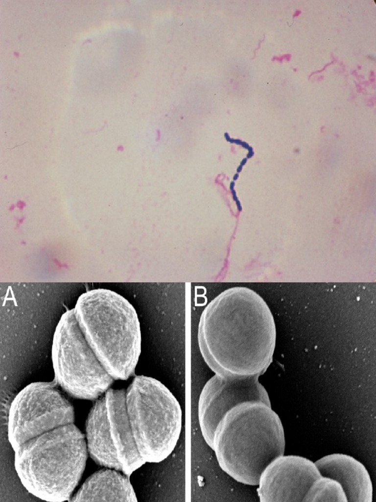 Streptococcus | PDF | Estreptococo | Microbiología