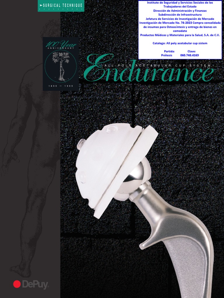 All Poly Acetabular Cup Sistem | PDF