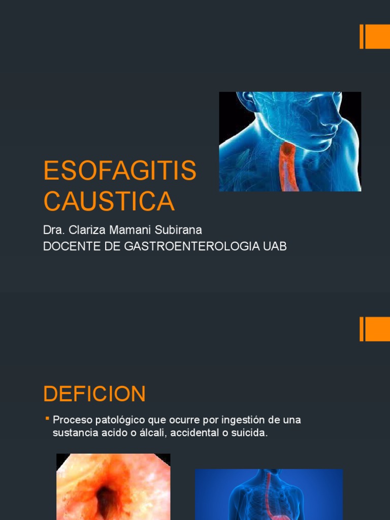 1 - ESOFAGITIS CAUSTICA | PDF | Medicina | Causas de la muerte