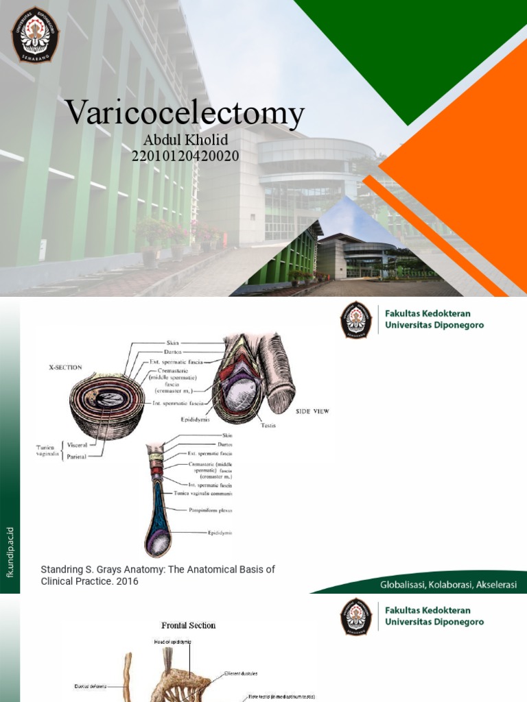 Optek Varicocelectomy Dengan Background Baru-1 | PDF