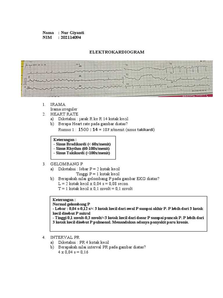 Interpretasi EKG | PDF