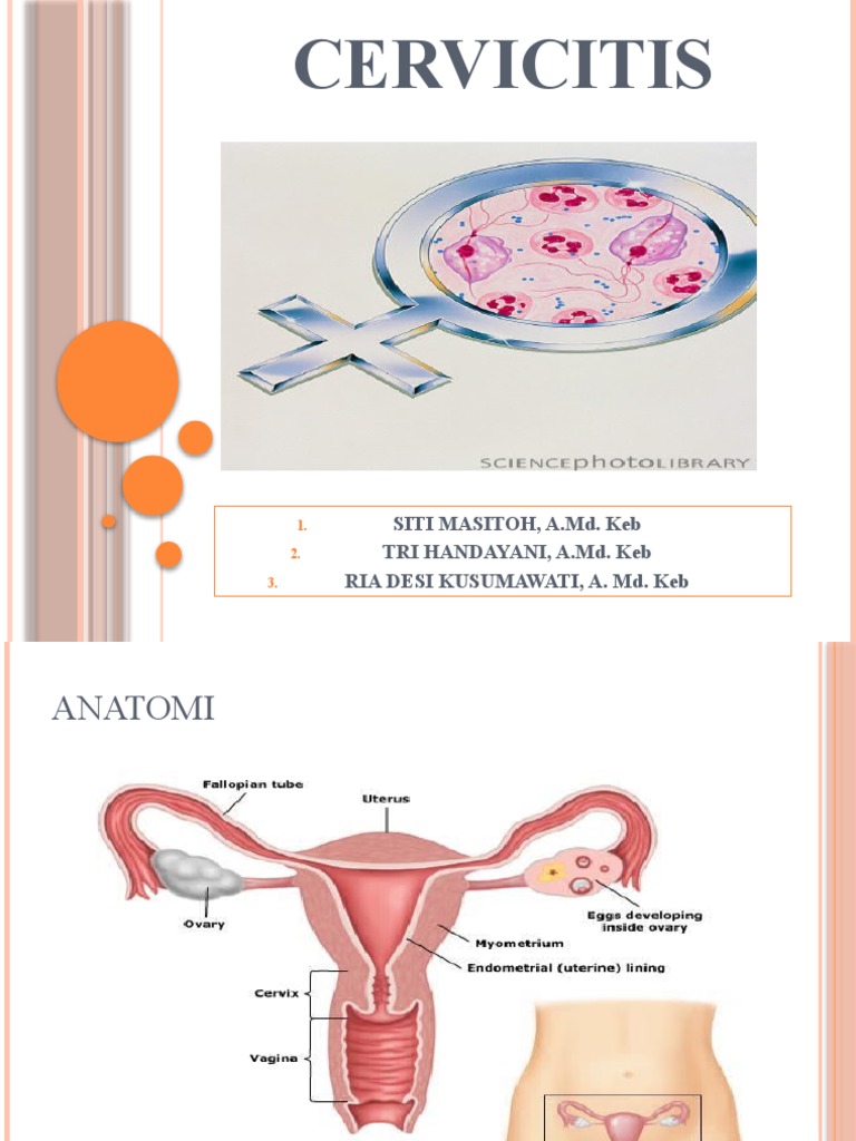 Panduan Lengkap tentang Cervicitis | PDF | Pengembangan Diri | Sains & Matematika