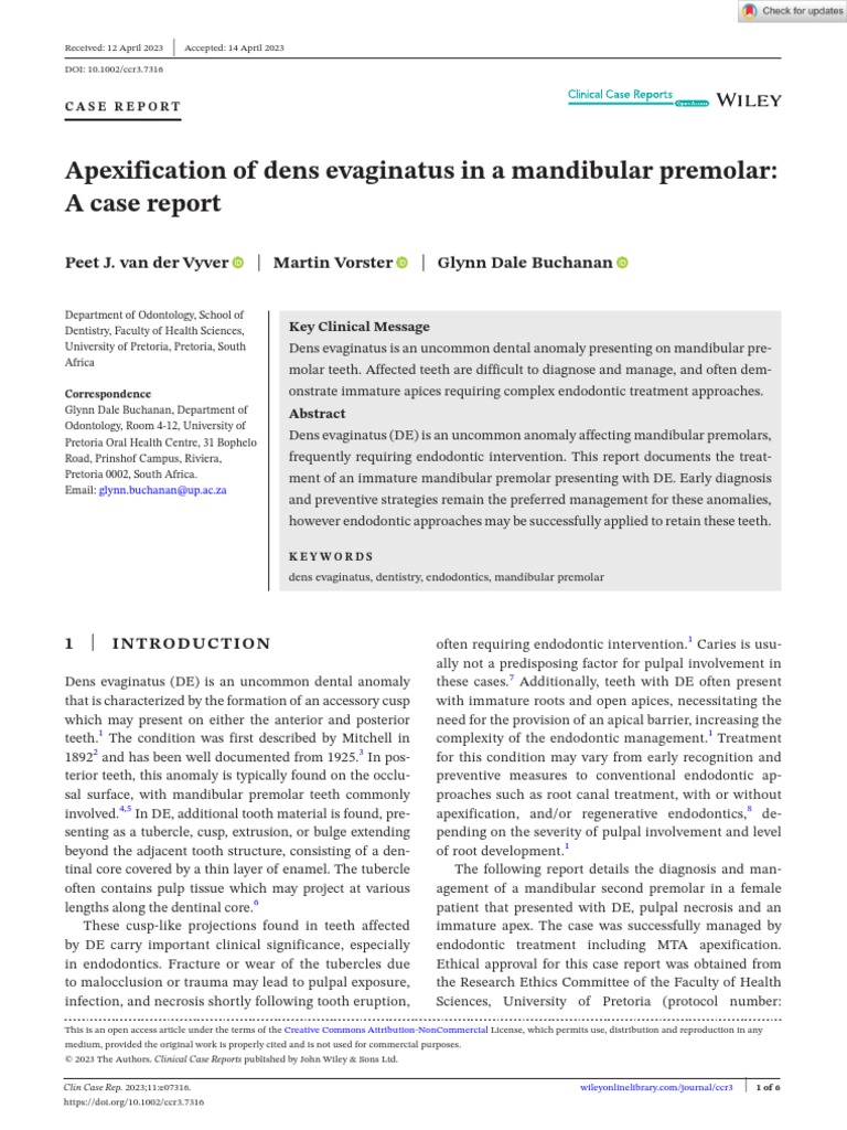 Clinical Case Reports - 2023 - Vyver - Apexification of Dens Evaginatus ...