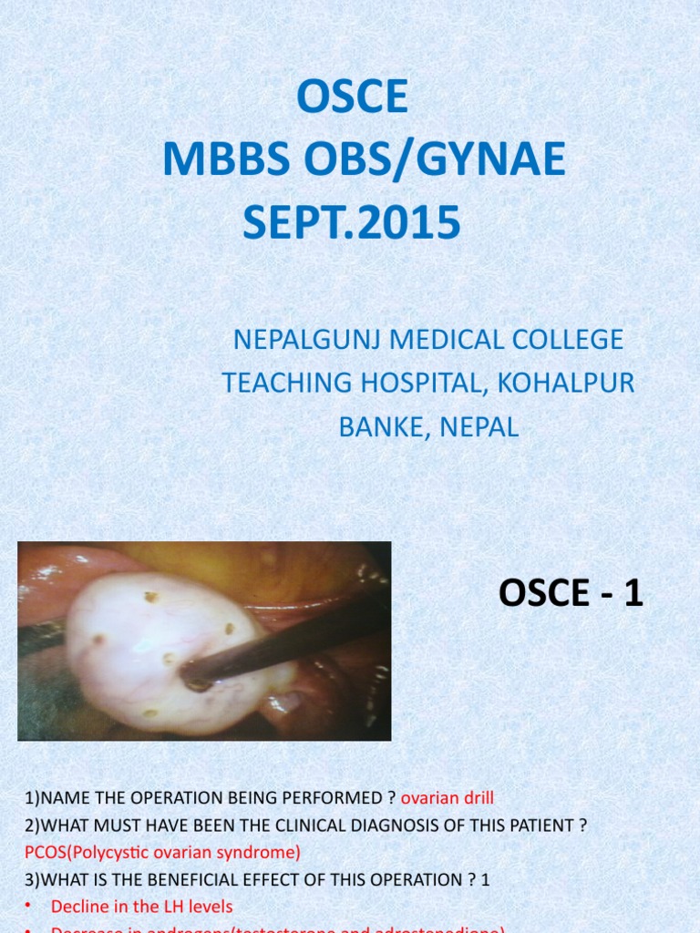 Gynae Osce | PDF | Polycystic Ovary Syndrome | Childbirth