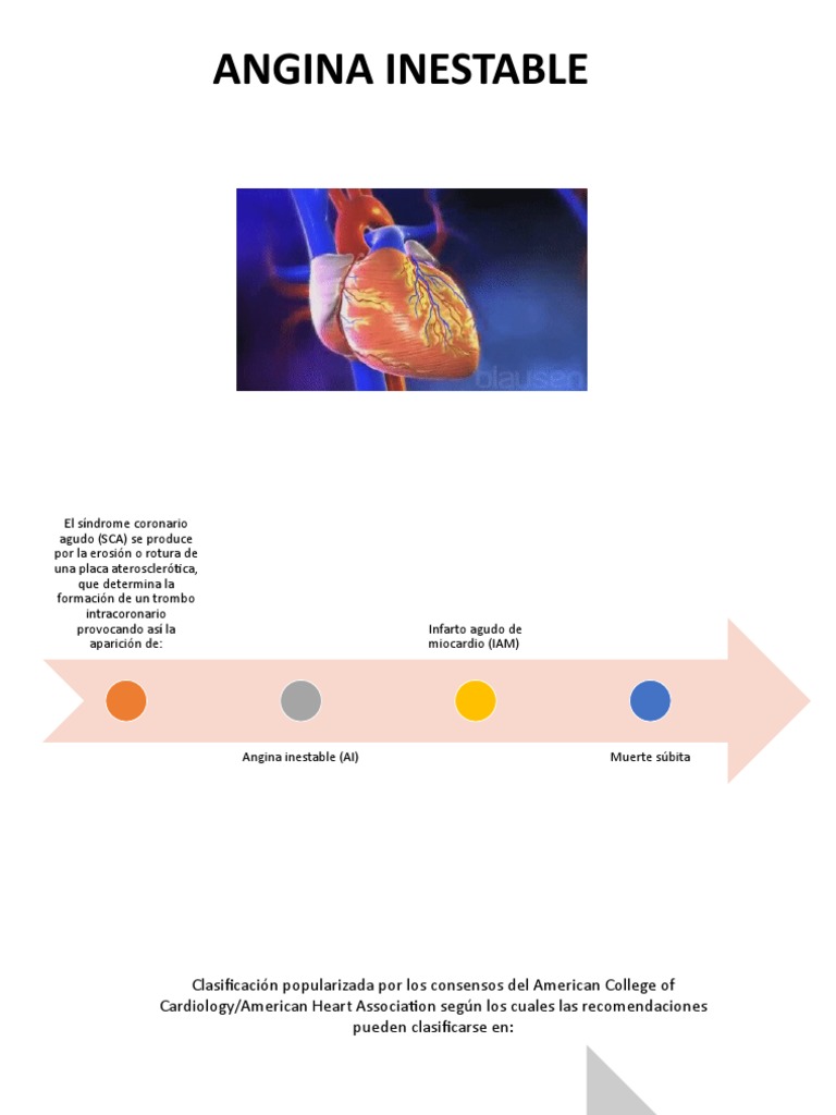 Manejo de Angina Inestable/IAM | PDF | Infarto de miocardio | Corazón