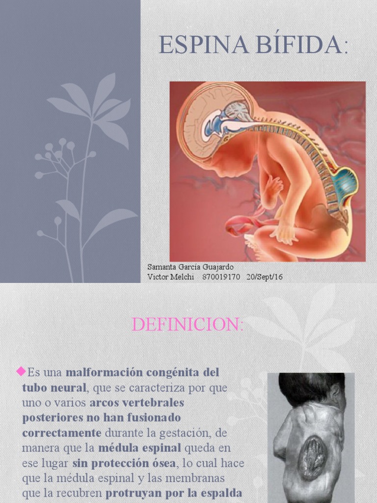Espina Bífida: Tipos, Causas y Tratamiento | PDF | Medicina CLINICA | Causas de la muerte