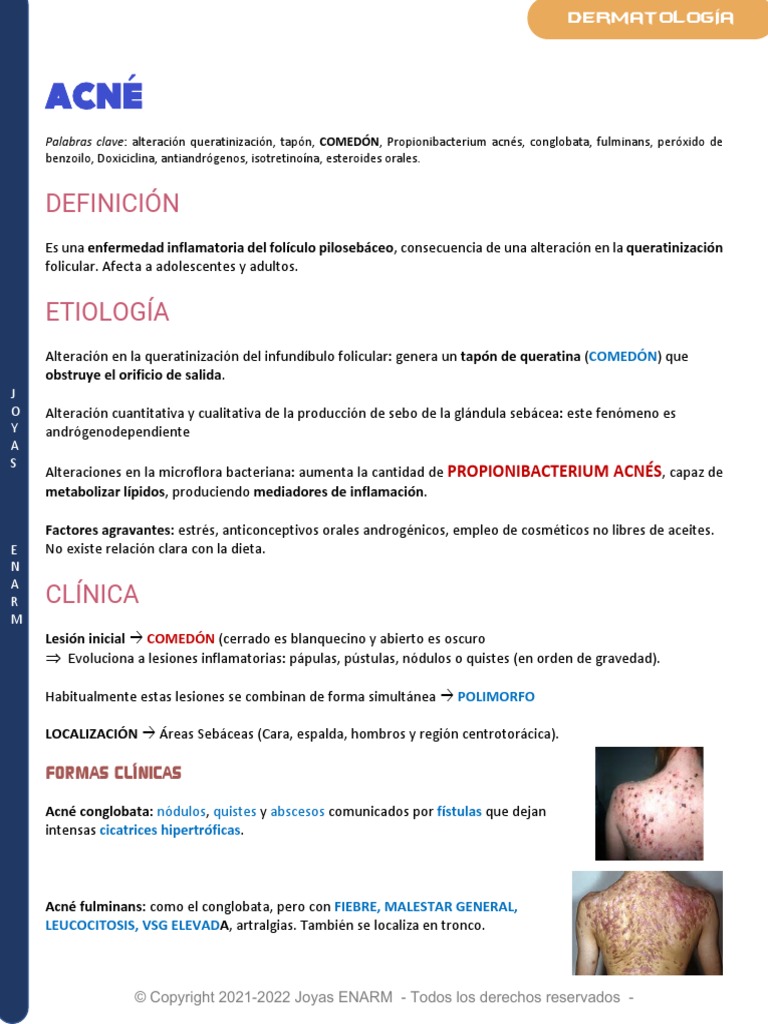 Acné | PDF | Dermatología | Especialidades Medicas
