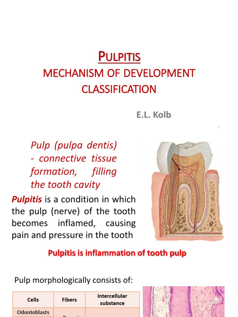 Lecture_6-1_Pulpitis, mechanism of development, classification (1 ...
