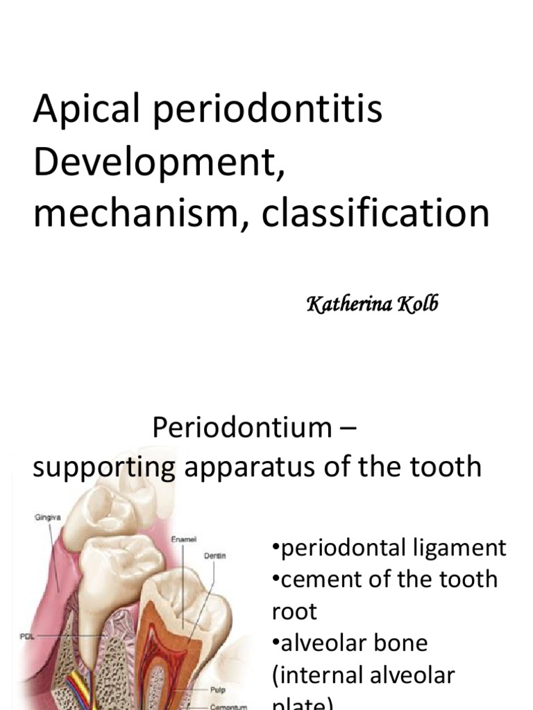 Lecture - 6-5 - Apical Periodontitis. The Development Mechanism, Classification | PDF ...