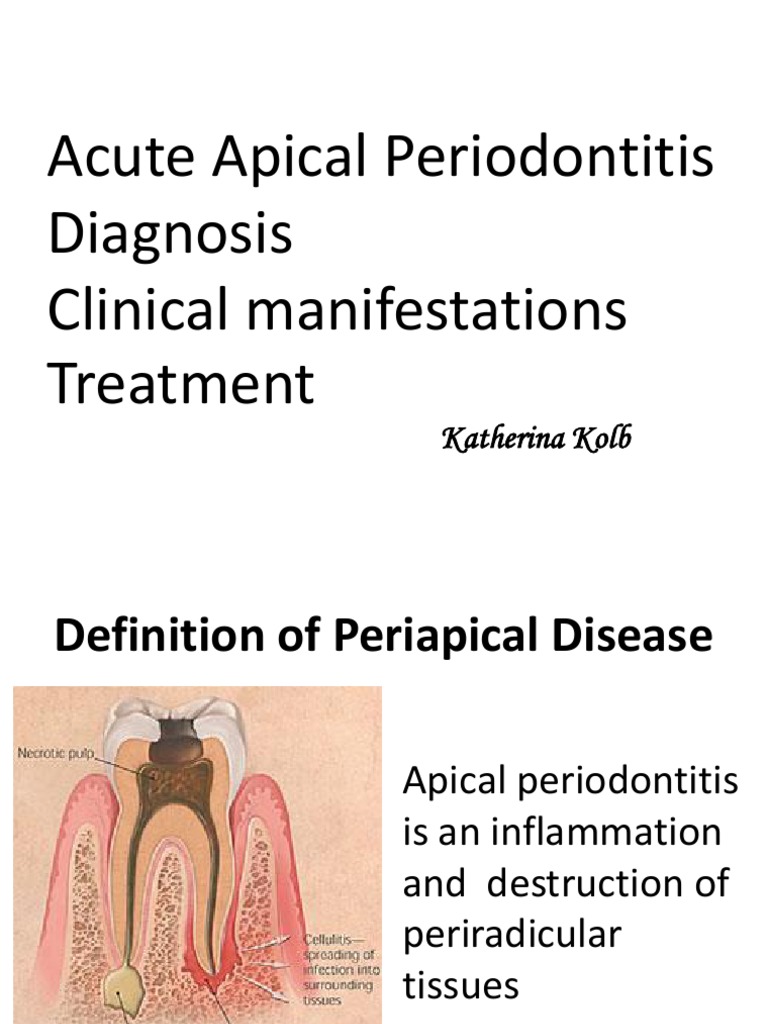 Lecture - 6-6 - Acute Apical Periodontitis Diagnosis Clinical ...