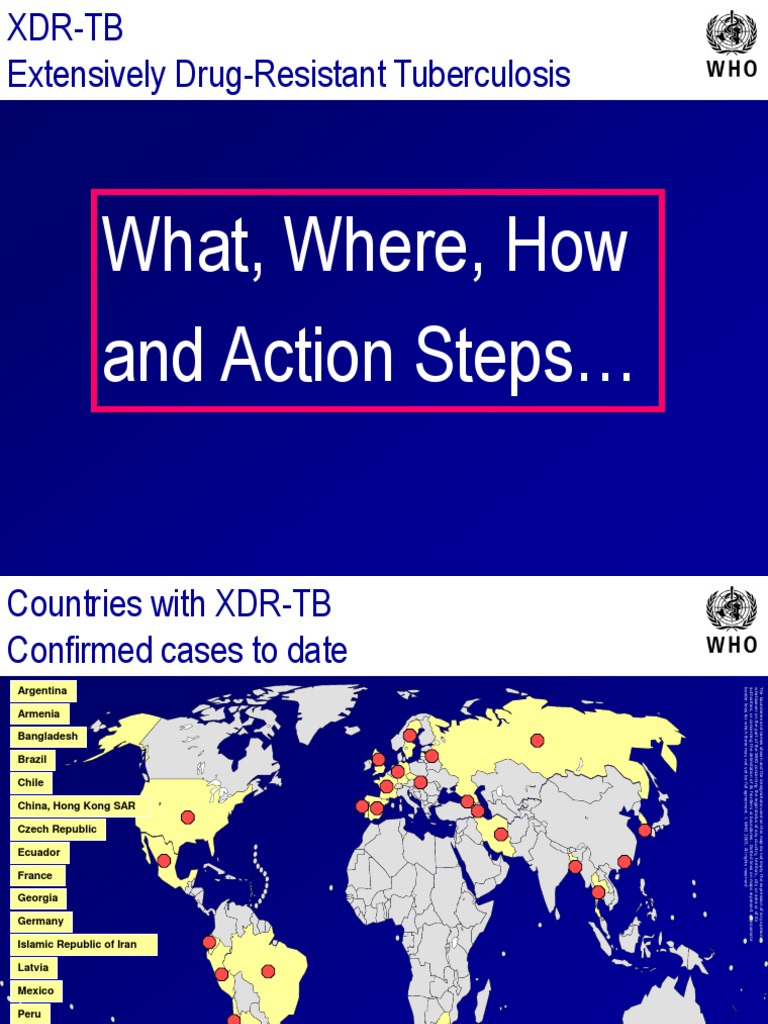 XDR-TB: Understanding the Facts About Extensively Drug-Resistant ...