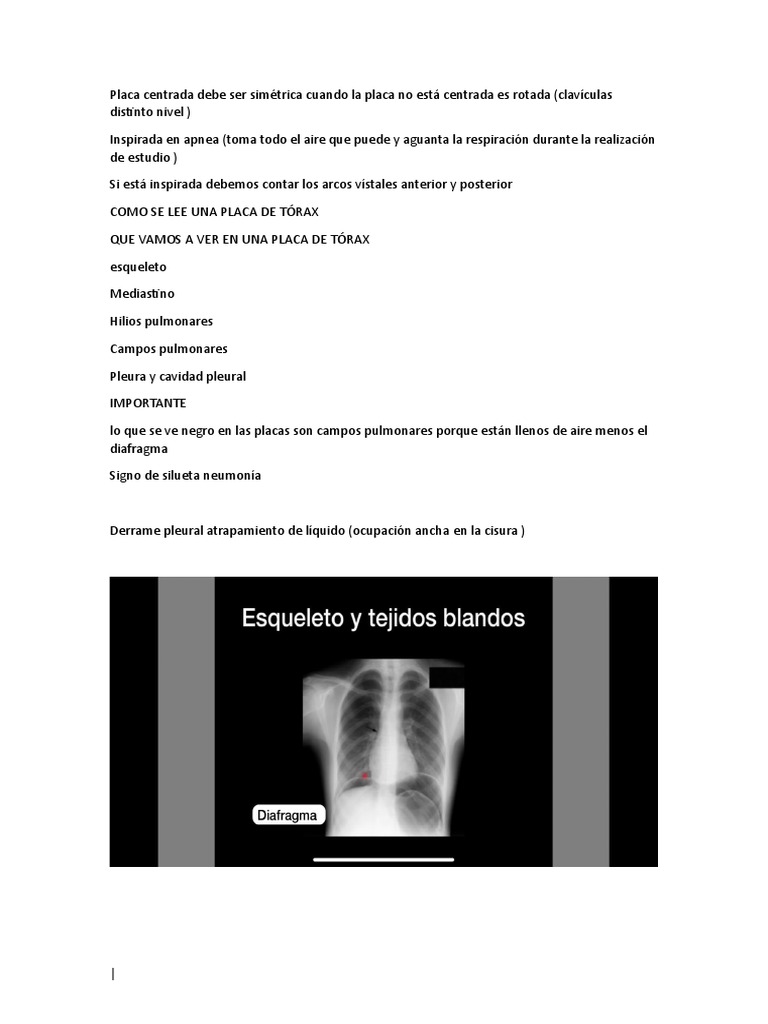 Resumen Radiografia De Torax Pdf