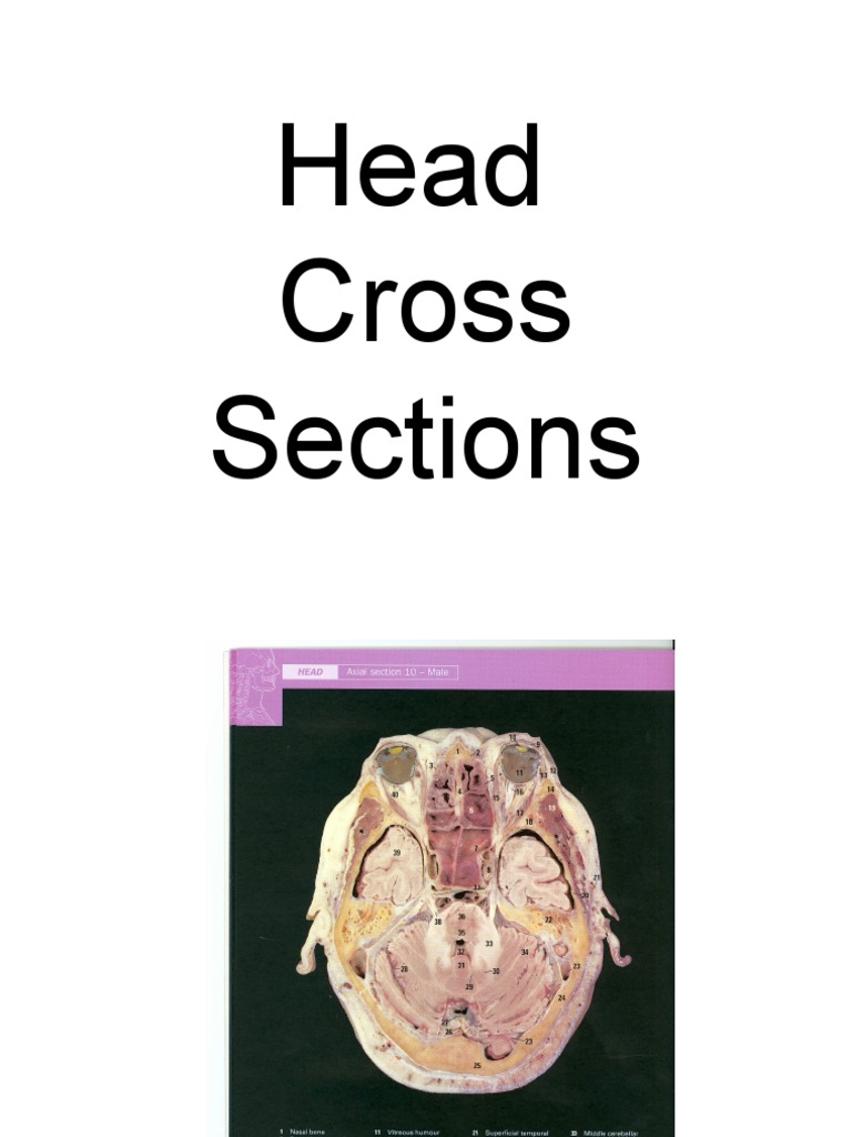 Cross Sections | PDF