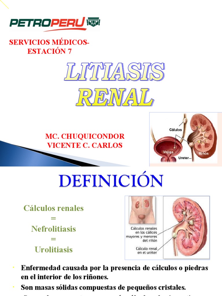 Litiasis Renal | PDF | Causas de la muerte | Medicina