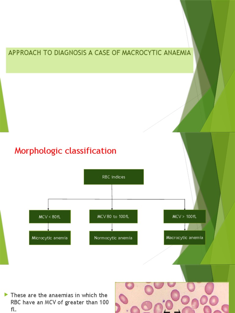 A Diagnostic Approach To Macrocytic Anemia | PDF | Anemia | Vitamin B12
