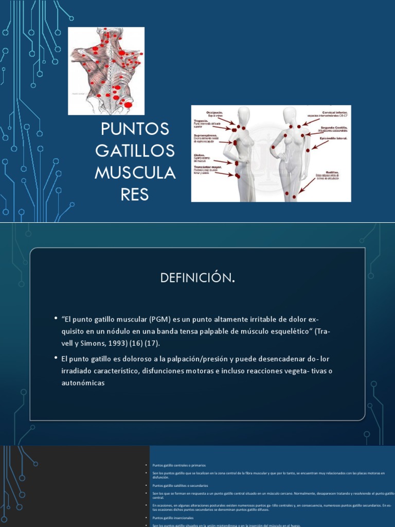 Puntos Gatillo | PDF | Punto gatillo miofascial | Fibromialgia