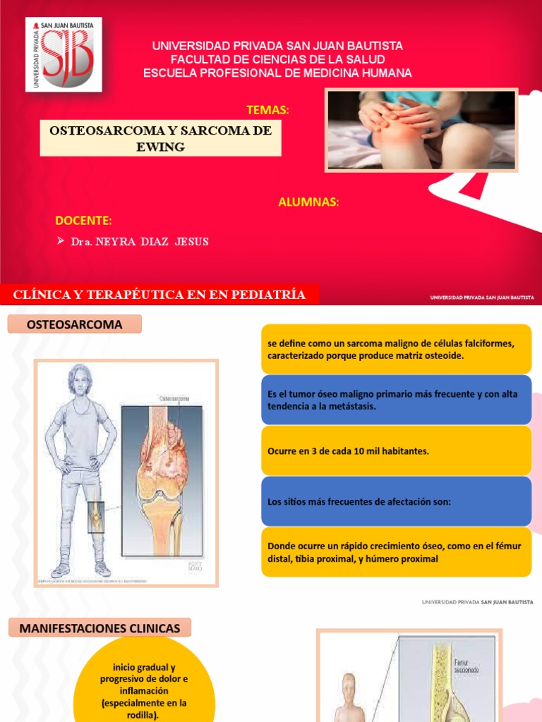 Osteosarcoma | PDF | Medicina CLINICA | Enfermedades y trastornos