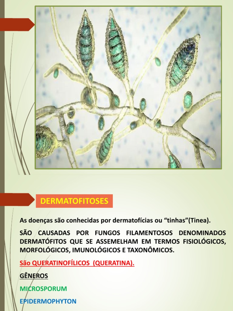 Dermatofitoses - Slides | PDF | Fungo | Epidemiologia