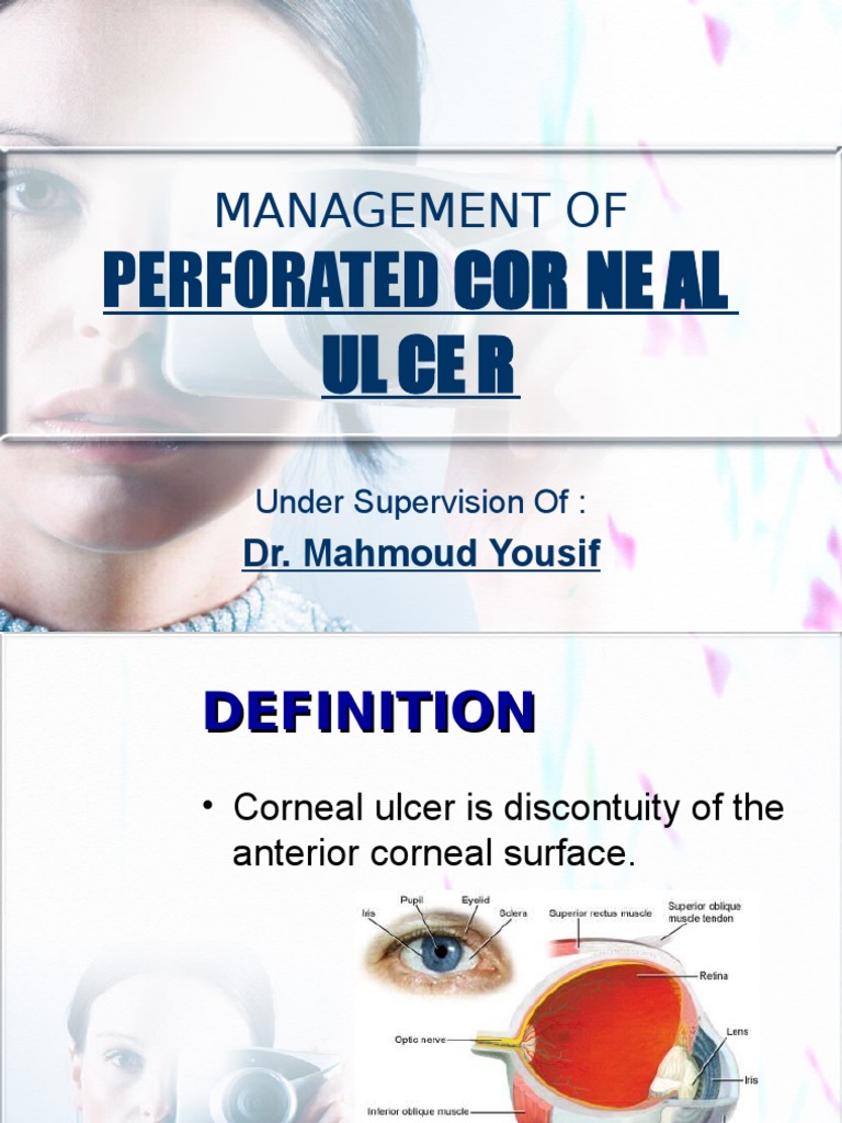 Management of Pcu | PDF | Ophthalmology | Medical Specialties