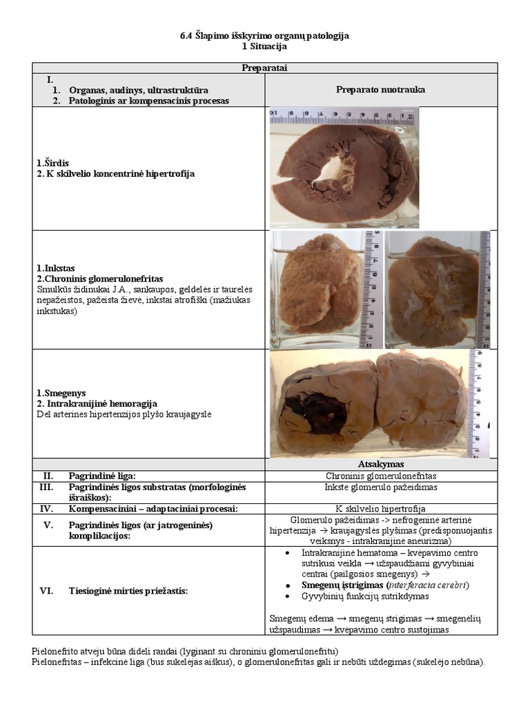 6.4 Preparatai. Inkstų Ligos Ir Sindromai Bei Jų Morfologiniai Pokyčiai ...