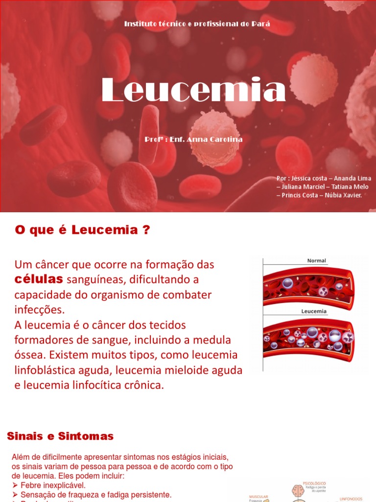 Trabalho Leucemia | PDF | Leucemia | Câncer