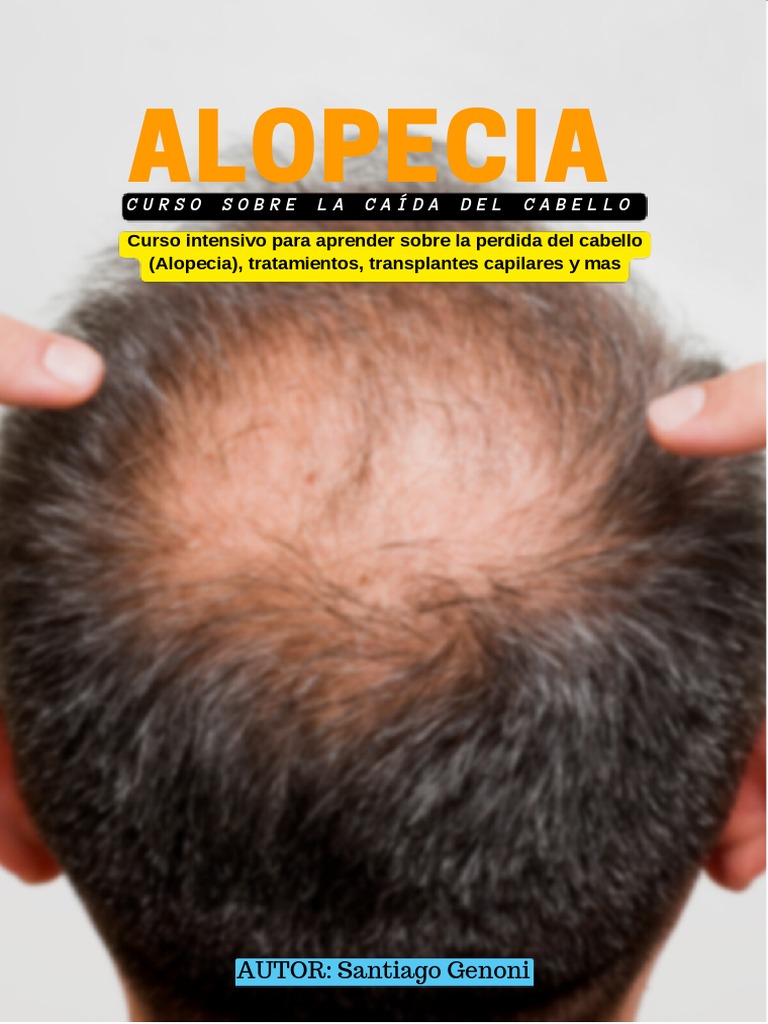 Guía Perdida de Cabello PDF | PDF | Perdida de cabello | Apariencia humana
