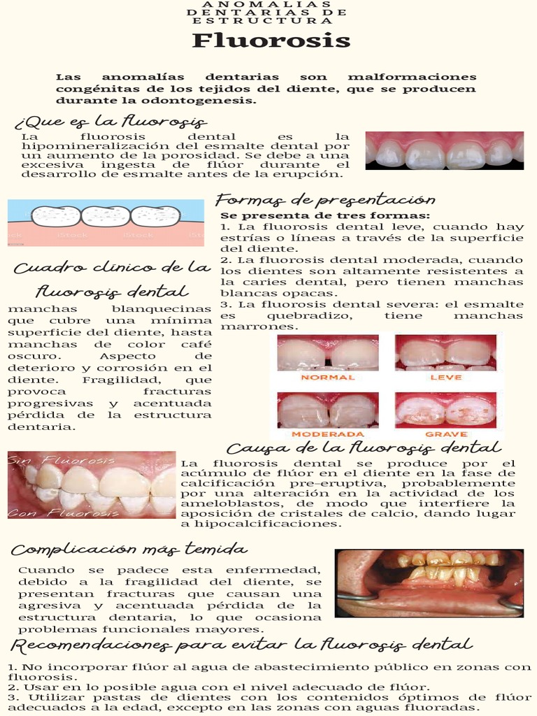 Rotafolio 3 (Claudio, Paola y Anali 1C) | Descargar gratis PDF | Diente ...