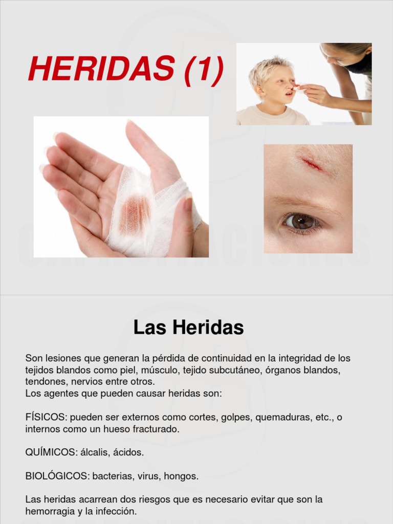 Heridas, Hemorragias, Quemaduras y Vendajes (1) | PDF | Herida | Primeros auxilios