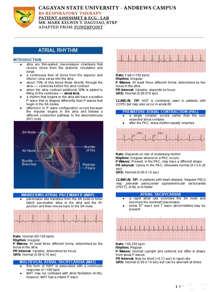 Atrial-Rhythm 230518 191520-1 | PDF | Atrium (Heart) | Circulatory System