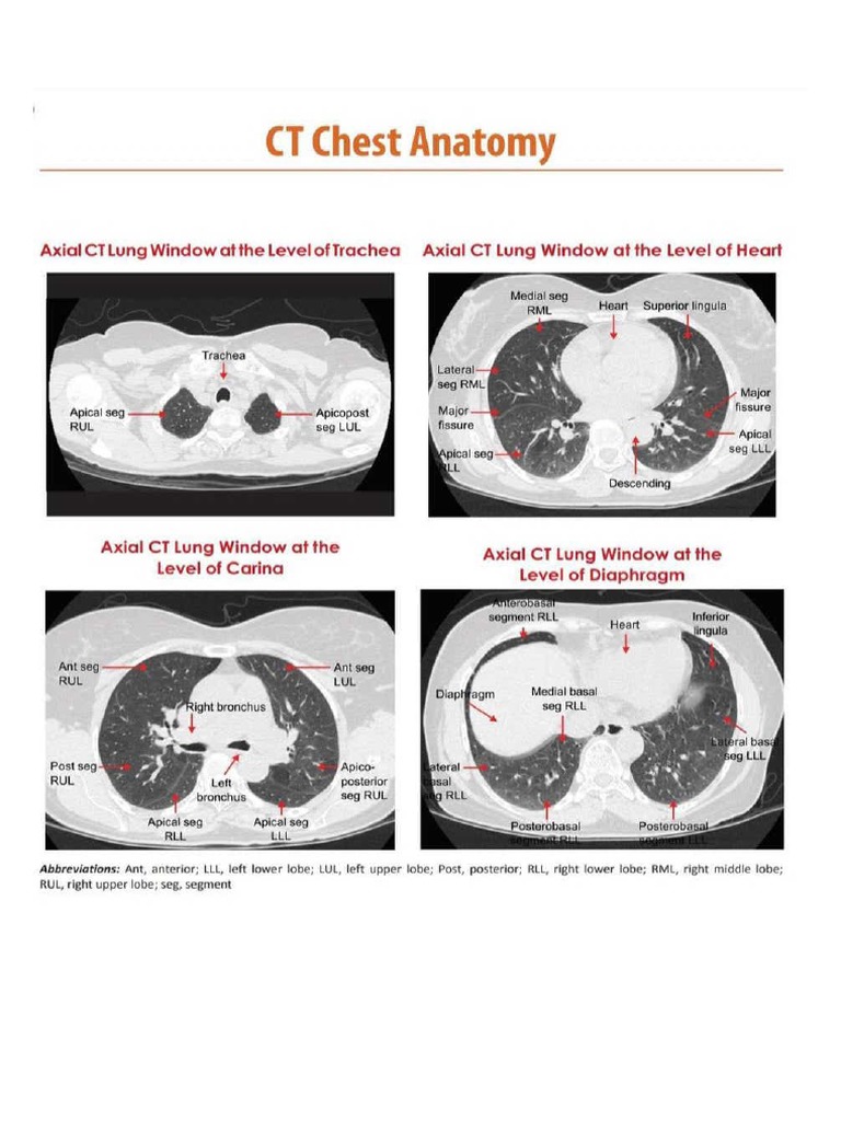 CT_angiography_Anatomy_ ?_1684682696 | PDF