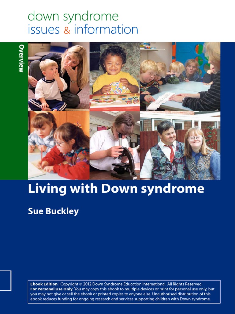 Living With Down Syndrome Ebook | PDF | Down Syndrome | Intellectual ...