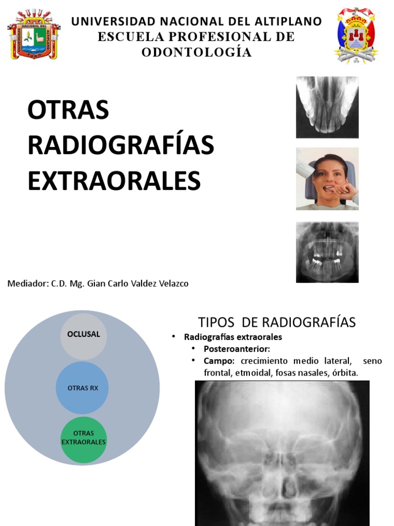 Tipos de Radiografías Extraorales | PDF | Anatomía humana | Cabeza y ...