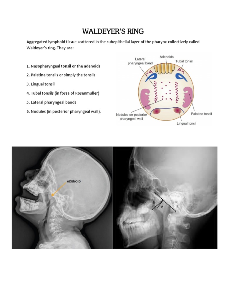 Ent MBBS Notes | PDF | Larynx | Otorhinolaryngology